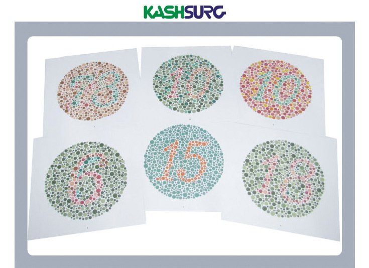 Colour Deficiency Test Cards For Adult Improved | Kashmir Surgical Works